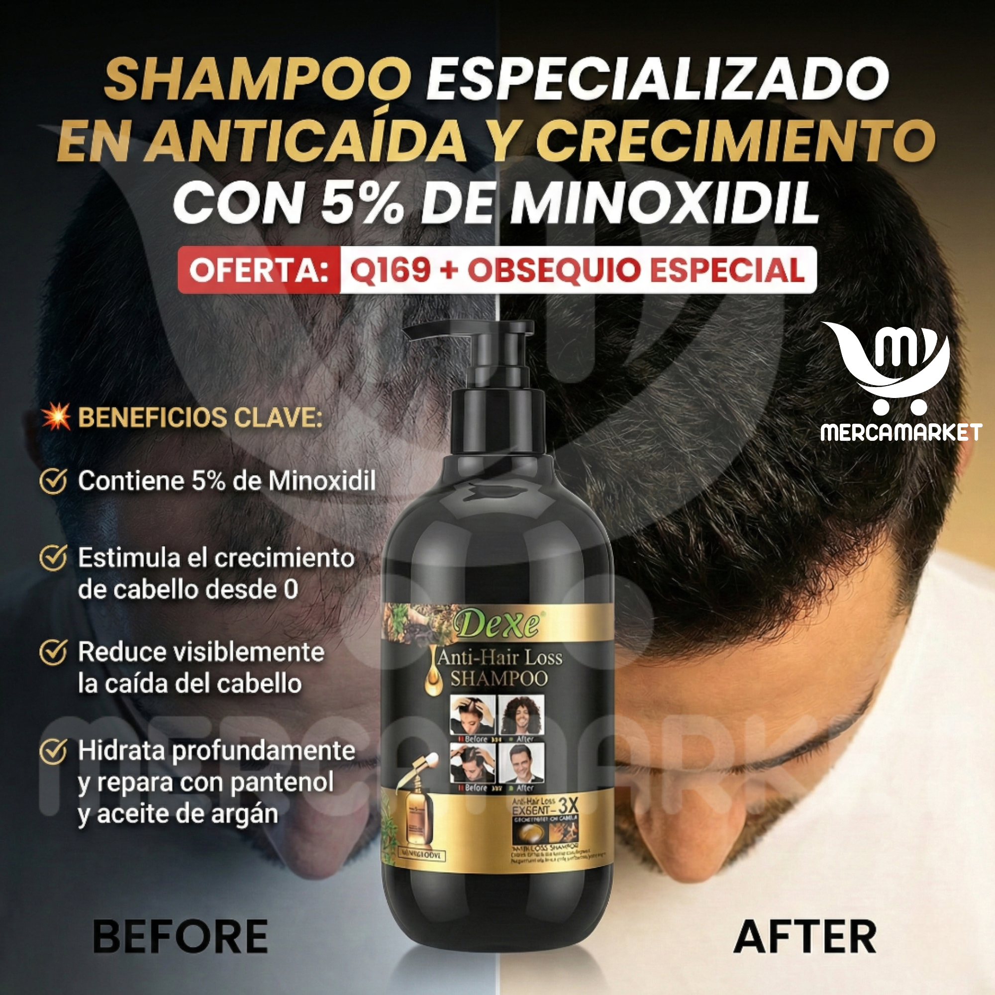 [💎 PRECIO IMPORTADOR + REGALO] Shampoo Especializado en Anticaída y Cr ...